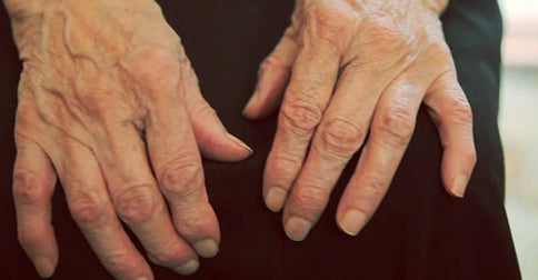 How to Deal with Thinning Skin – DRMTLGY