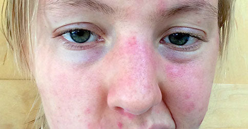 DRMTLGY Blog de Cuidado de la Piel Médico